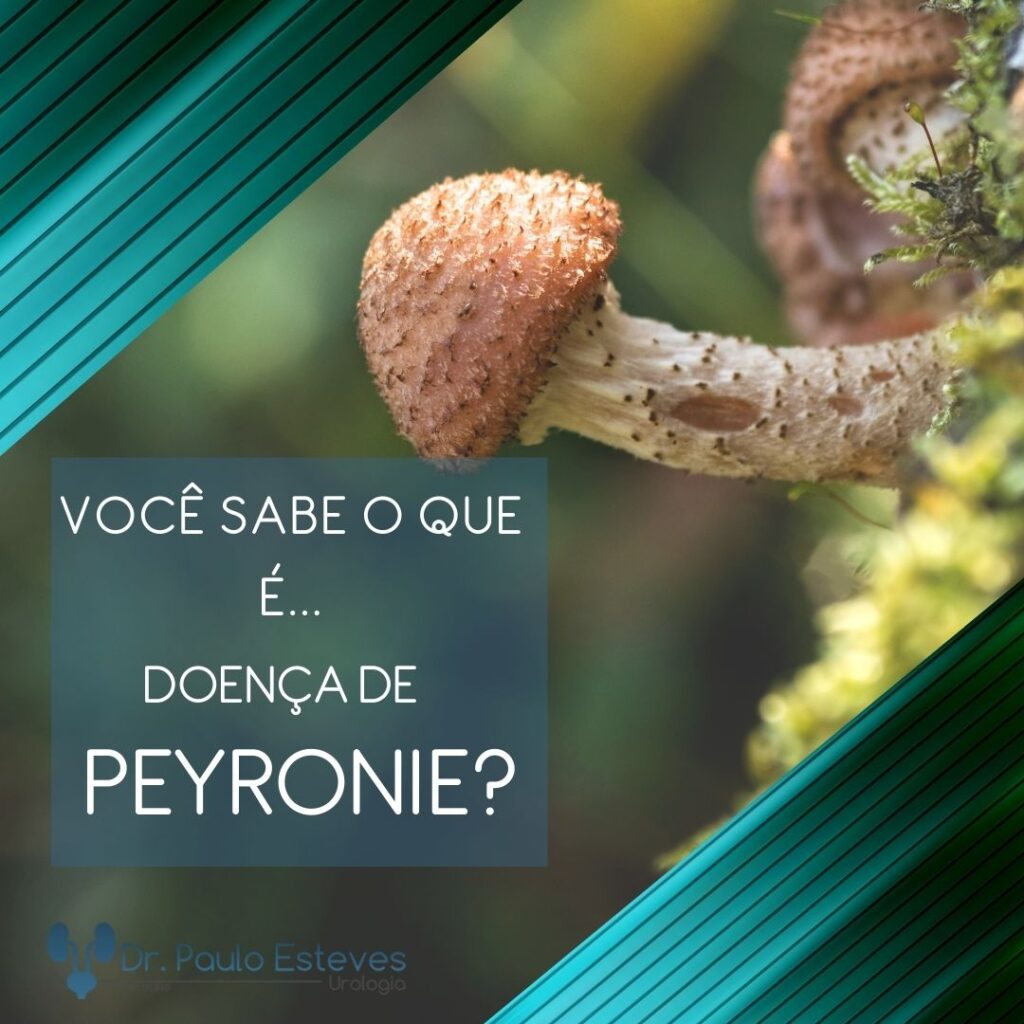 O que é a Doença de Peyronie? - Dr Paulo Esteves